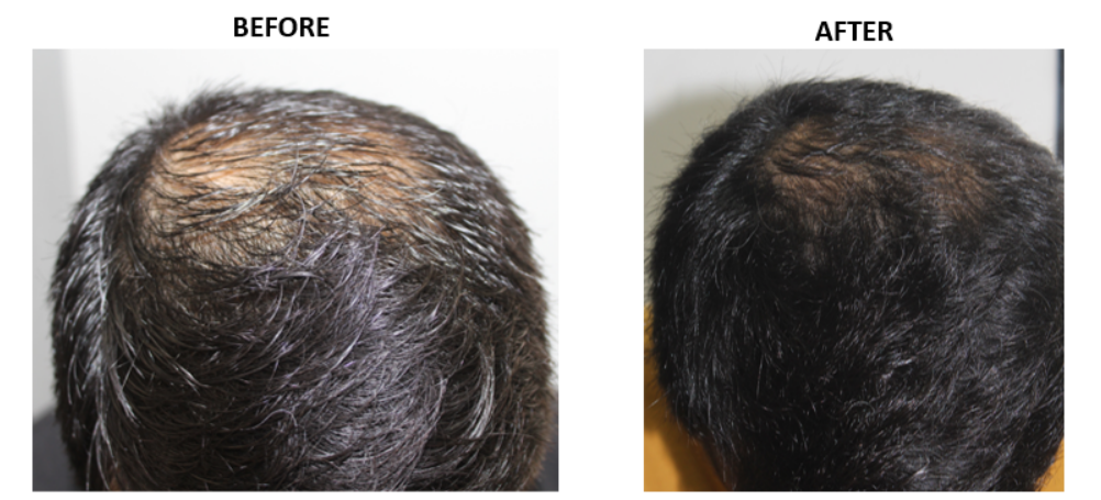 Why Your Hair Isn’t Growing — And How to Fix It
